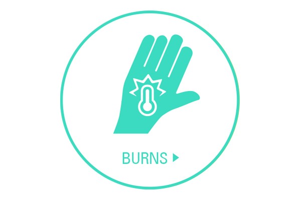 Help Soothe Stings, Minor Burns & Bites | SOOV Australia